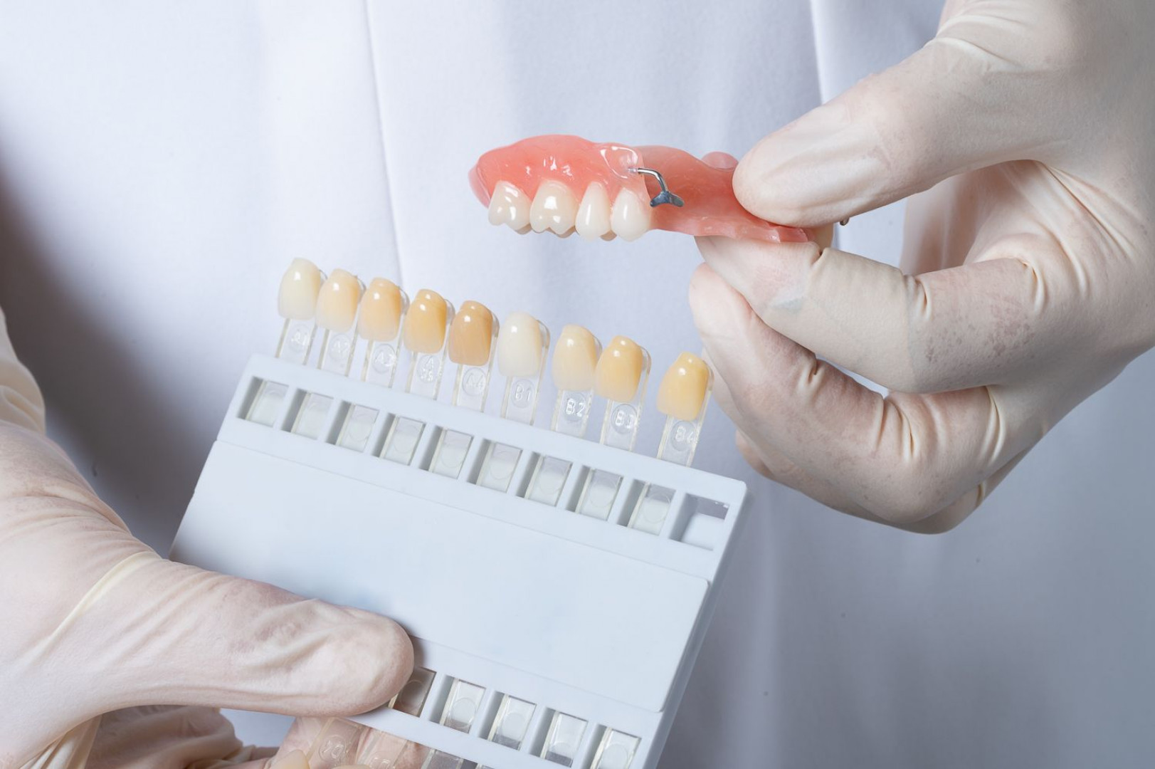 Dental Code for All-Ceramic Crowns