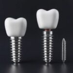 The Comprehensive Guide to Screwless Dental Implants cost