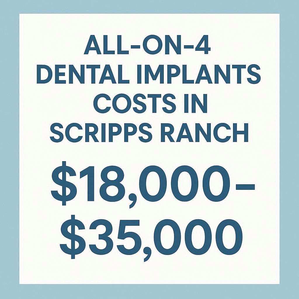 The Definitive Guide to All-on-4 Dental Implants Costs in Scripps Ranch